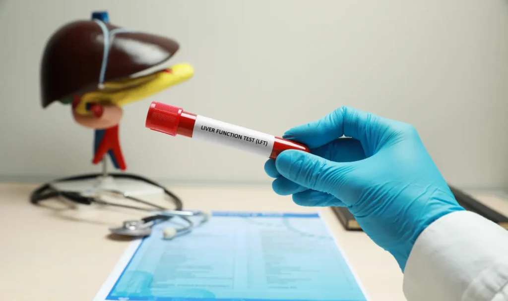 Our Test – Kitonic